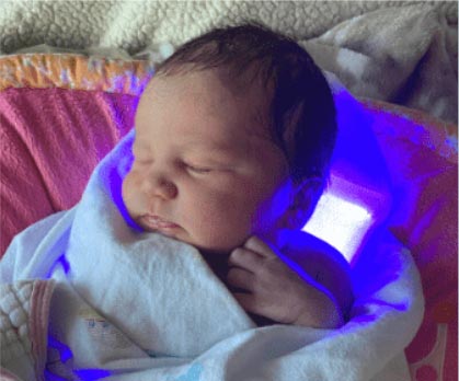 Ginny and Elena's Anti-D Story - Allo Hope Foundation