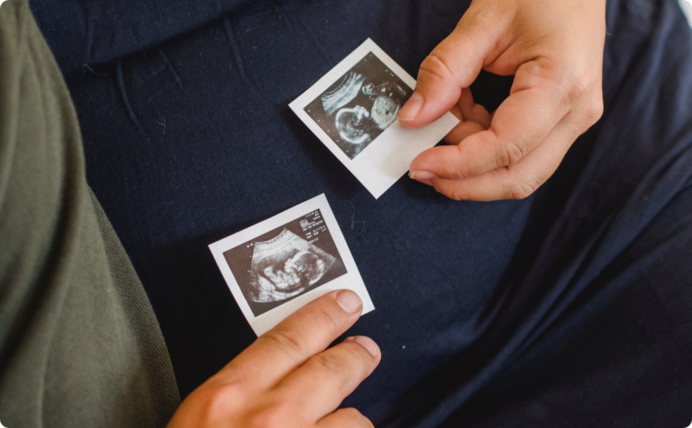 Interventions During Pregnancy - Allo Hope Foundation